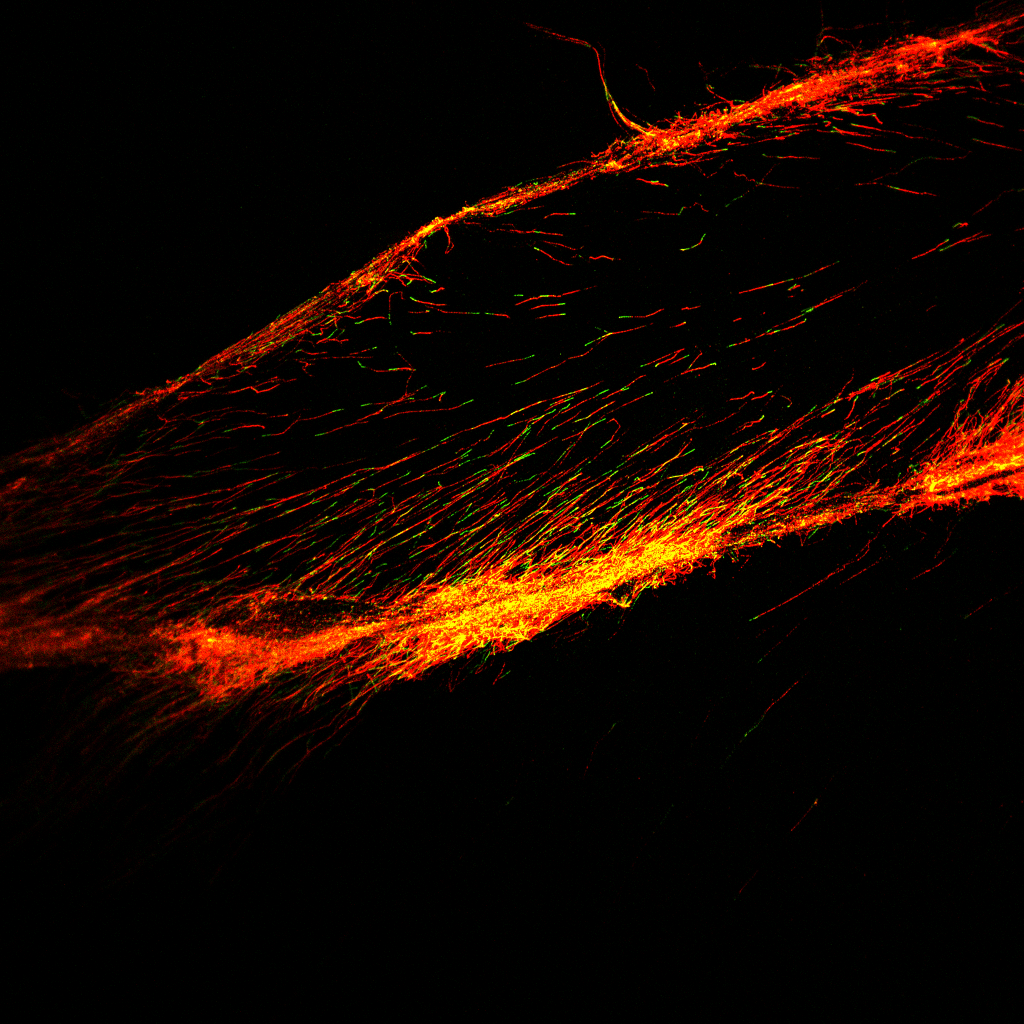 DNA fiber assay – Wenpeng Liu Lab in University of Virginia